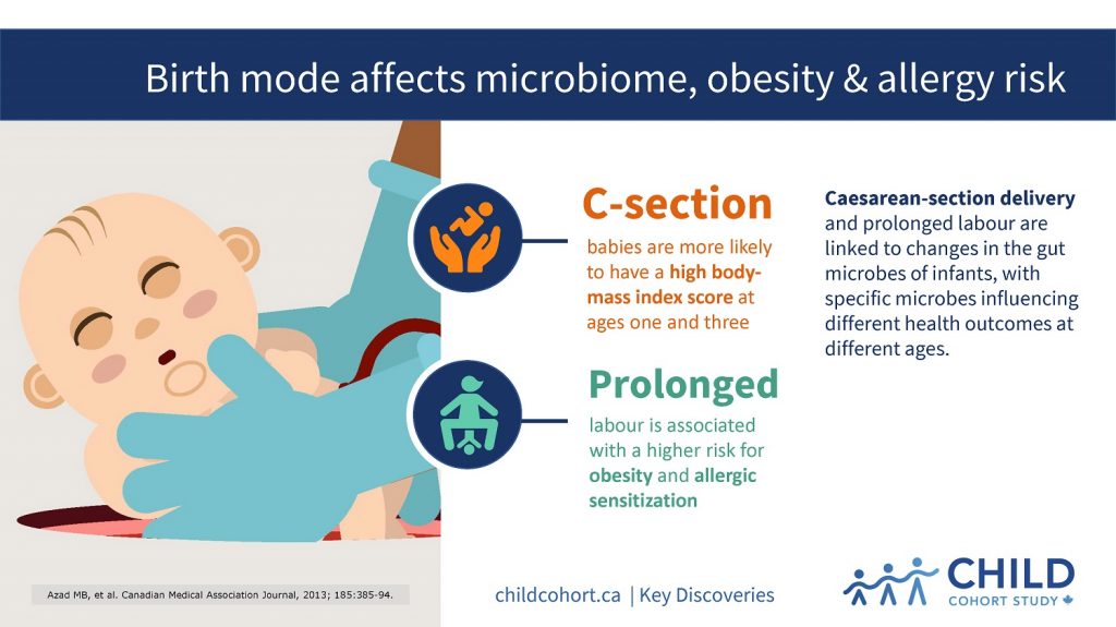 Birth mode affects microbiome, obesity & allergy risk - CHILD Cohort Study